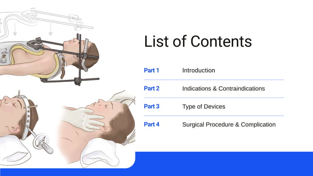 Cervical Traction.pptx