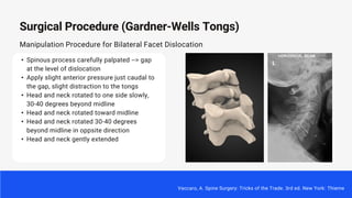 Cervical Traction.pptx