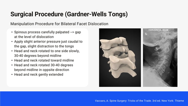 Cervical Traction.pptx