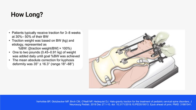 Cervical Traction.pptx