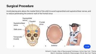 Cervical Traction.pptx