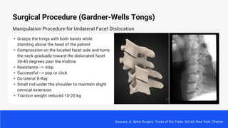 Cervical Traction.pptx