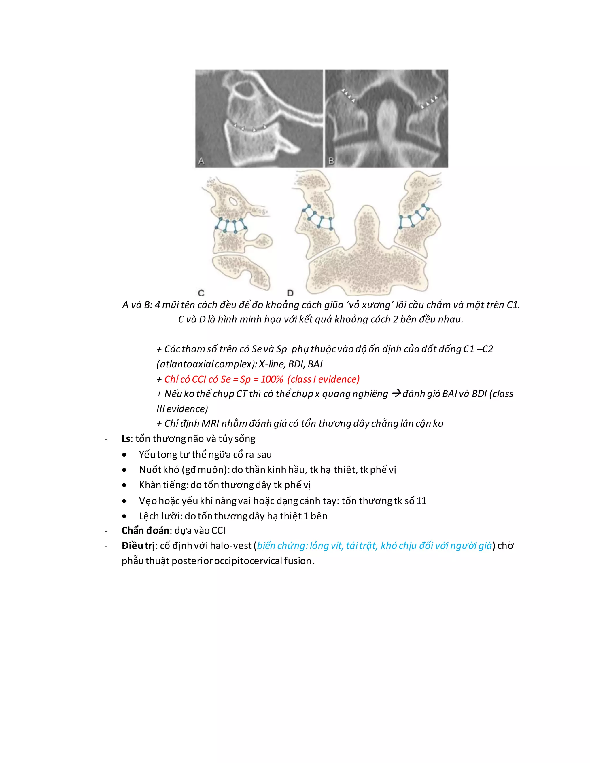 Chấn thương cột sống cổ - Cervical trauma. | DOCX