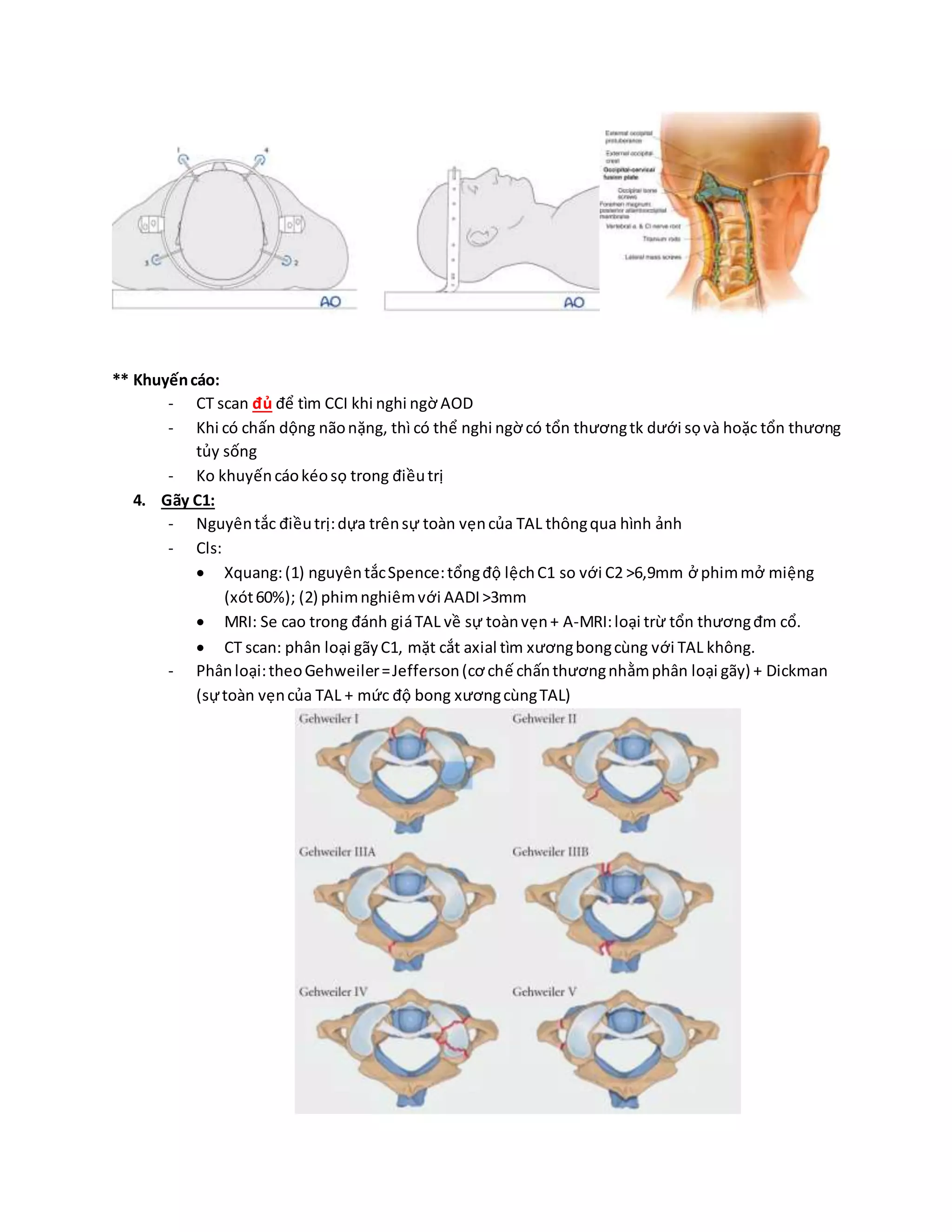 Chấn thương cột sống cổ - Cervical trauma. | DOCX