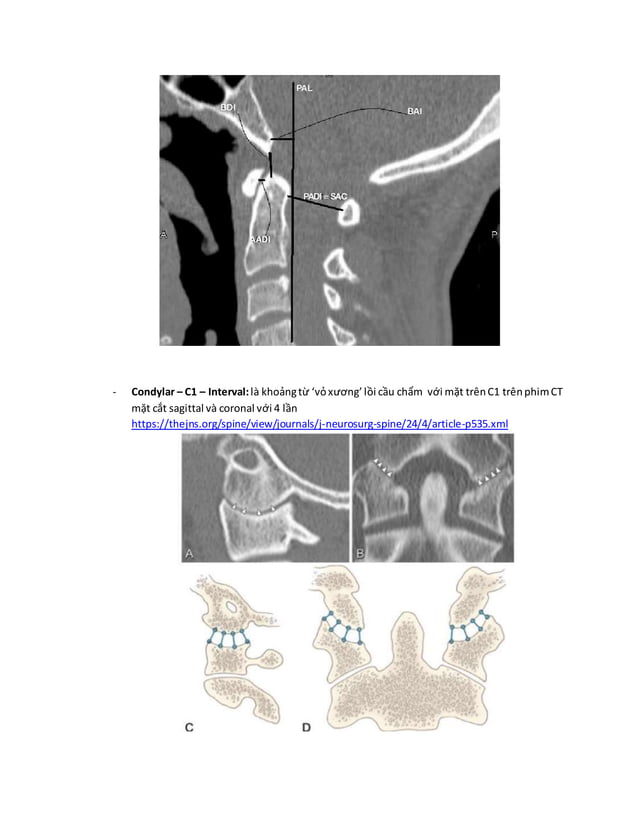 Chấn thương cột sống cổ - Cervical trauma. | DOCX