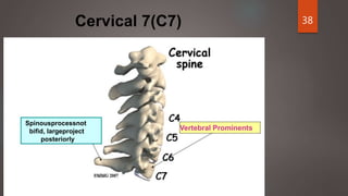 Cervical vertebra | PPT