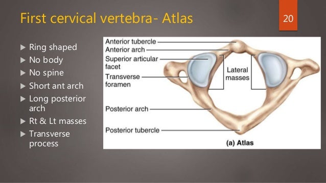 Cervical vertebra