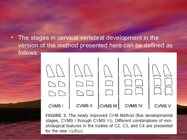 Cervical vertebrae maturation method
