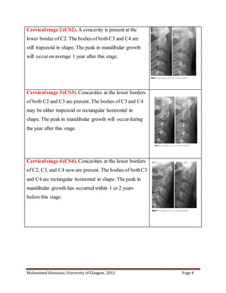 Cervical vertebral maturation (cvm) / for orthodontists by Almuzian | DOCX
