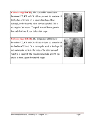 Cervical vertebral maturation (cvm) / for orthodontists by Almuzian | DOCX
