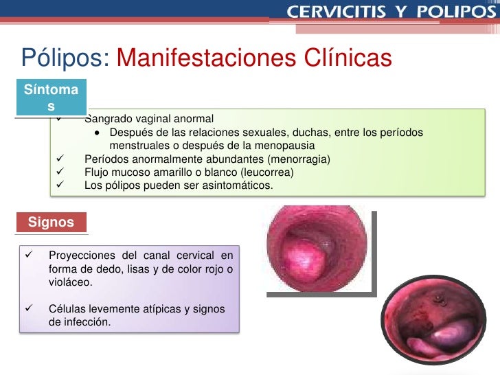 Cervicitis y polipos.ppt [reparado]