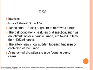 Cervicocerebral Arterial Dissections | PPTX