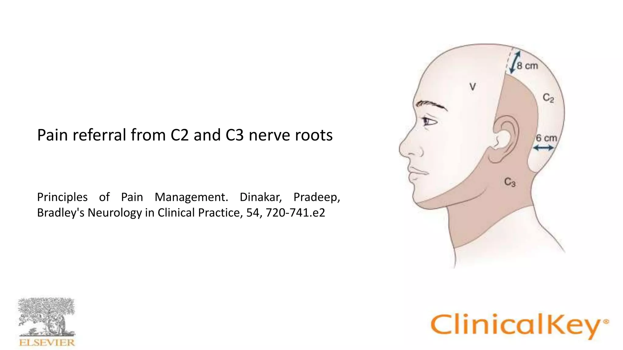 Cervicogenic Headache Following Lower Cervical RF Neurotomy | PPTX