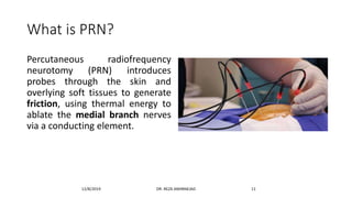 Cervicogenic Headache Following Lower Cervical RF Neurotomy | PPTX