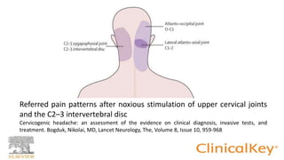 Cervicogenic Headache Following Lower Cervical RF Neurotomy | PPTX