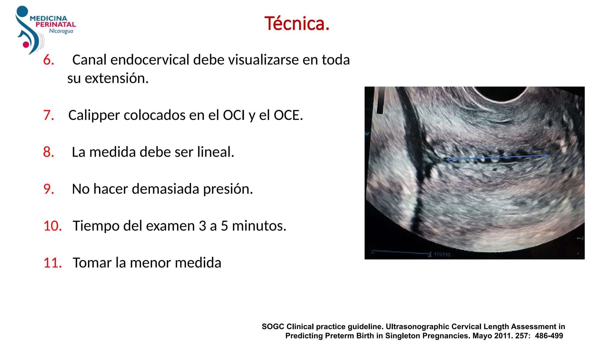 Cervicometría o longitud cervical examen radiologico de importancia en ...