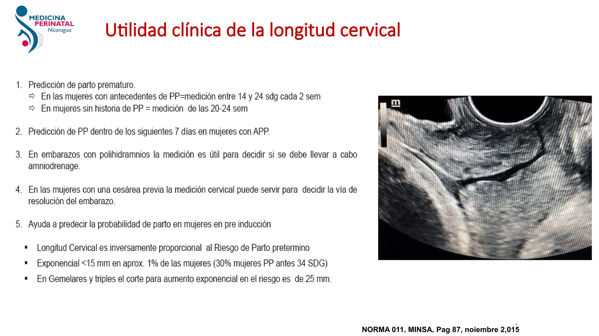 Cervicometría o longitud cervical examen radiologico de importancia en ...