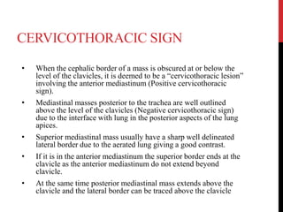 Cervicothoracic sign.pptx