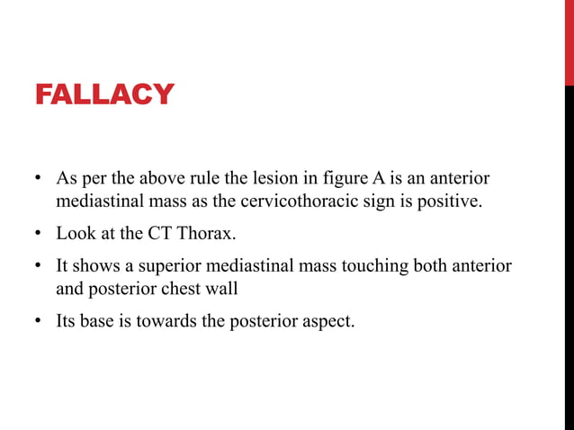 Cervicothoracic sign.pptx