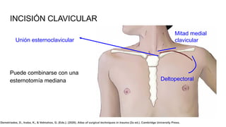 Cervicotomia- cirugia de cabeza y cuello | PPTX