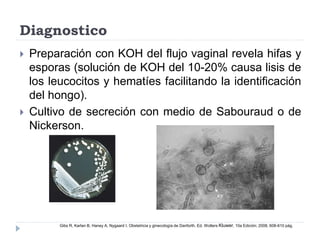 Cervicovaginitis Pptx