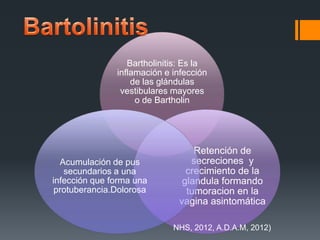 Bartolinitis