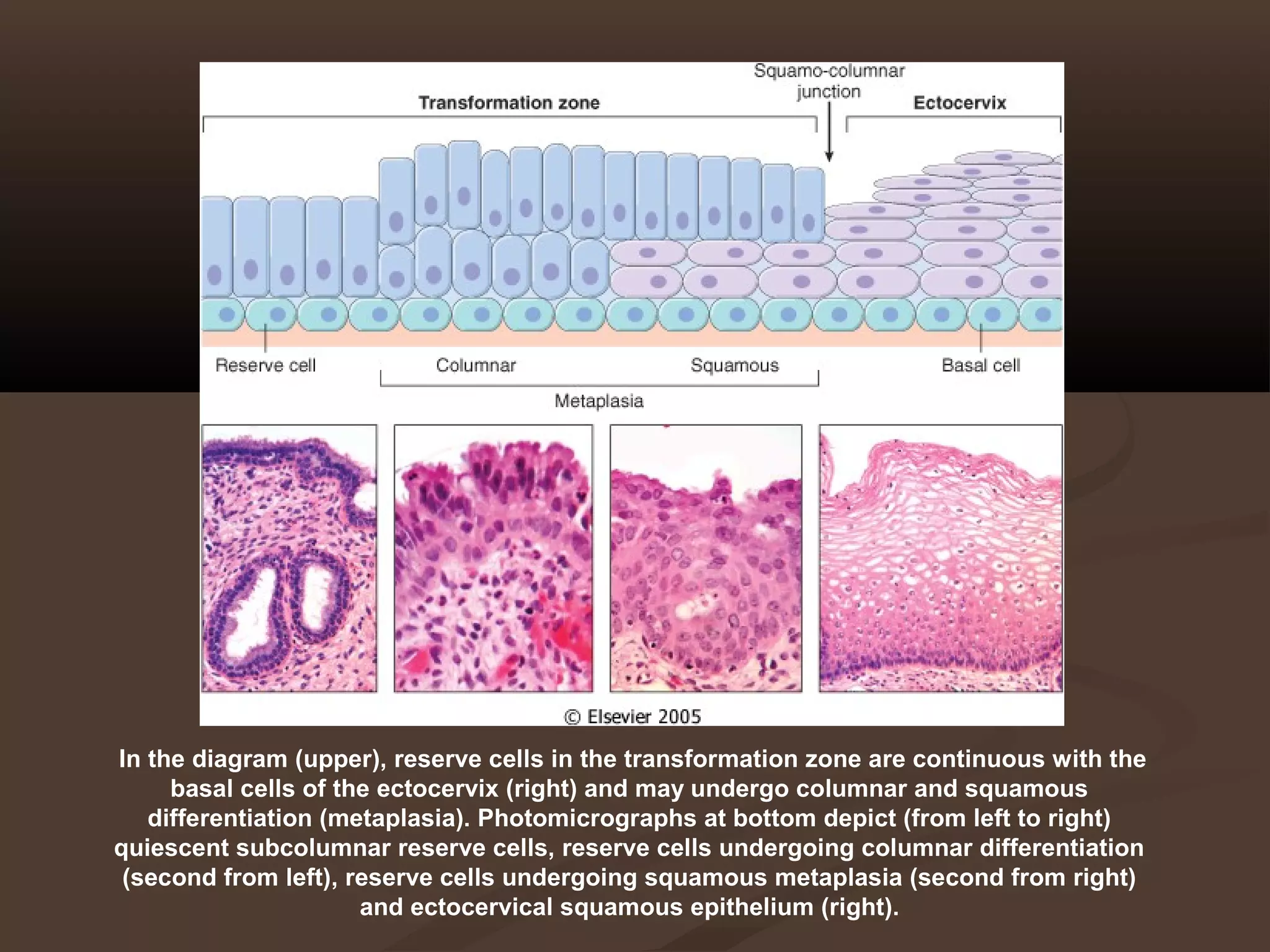 Pathology Of The Cervix Ppt
