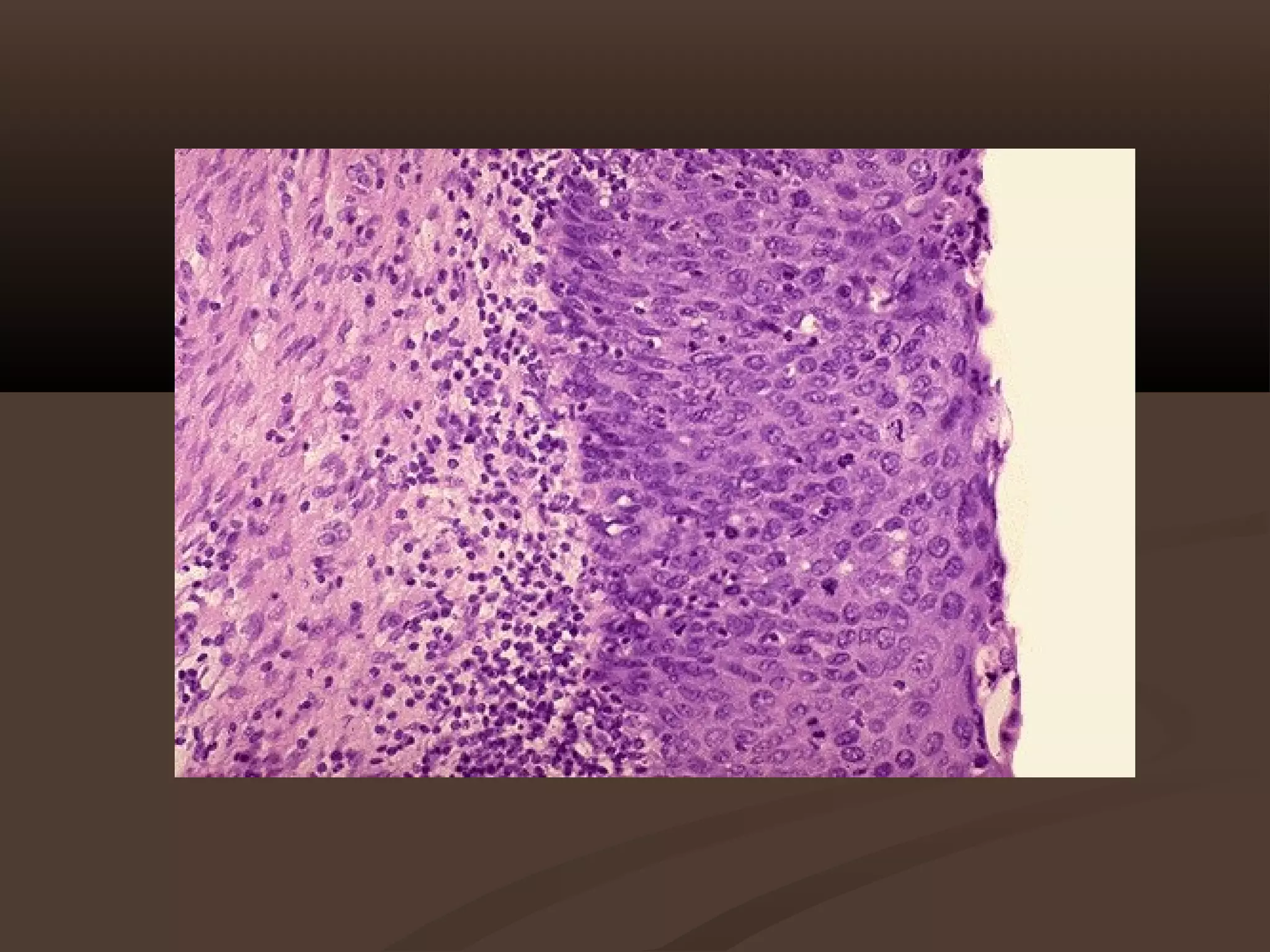 PATHOLOGY OF THE CERVIX | PPT