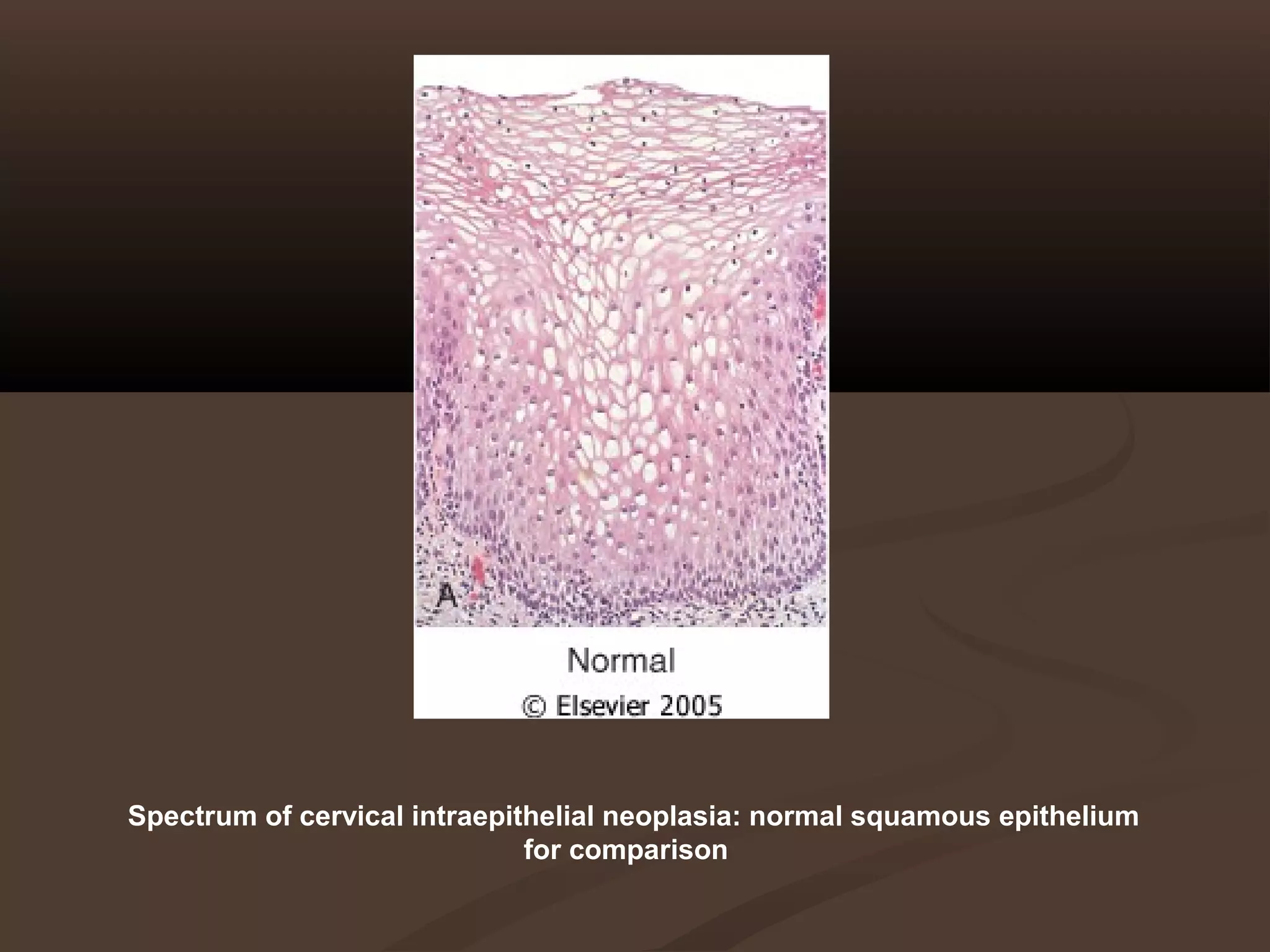 PATHOLOGY OF THE CERVIX | PPT