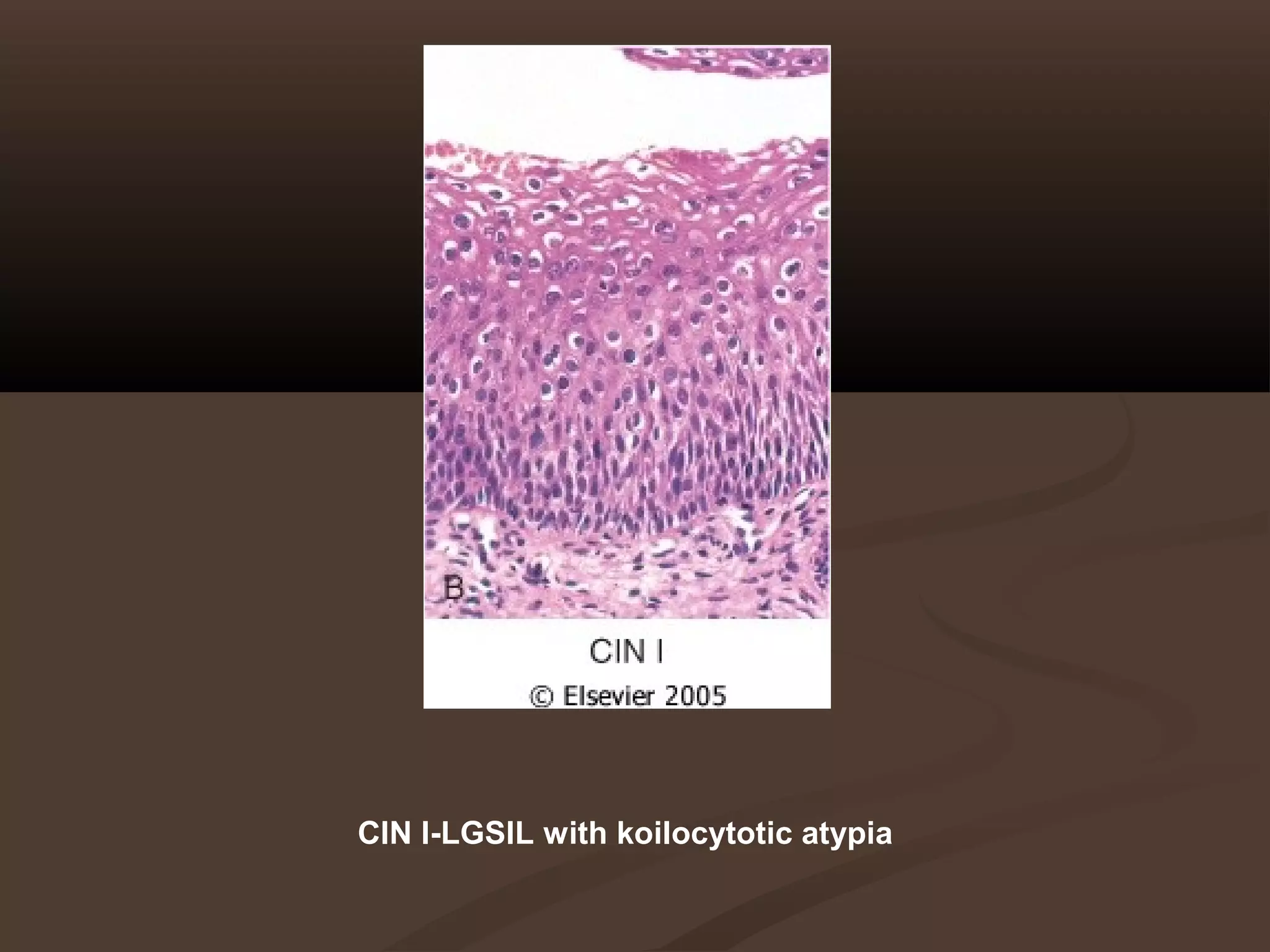PATHOLOGY OF THE CERVIX | PPT