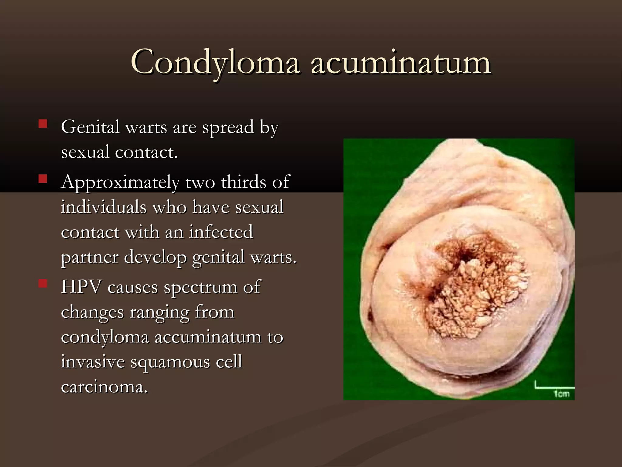 PATHOLOGY OF THE CERVIX | PPT