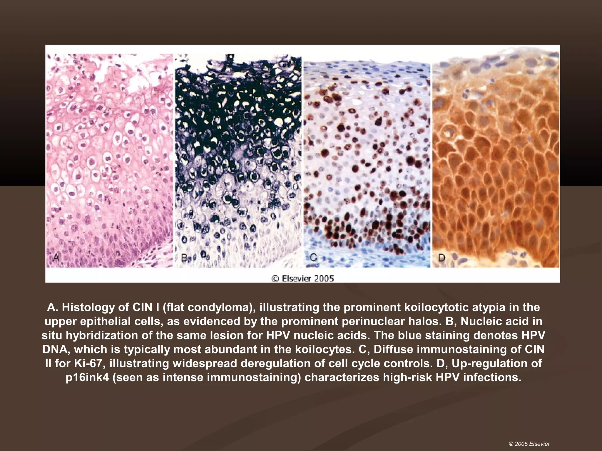 PATHOLOGY OF THE CERVIX | PPT