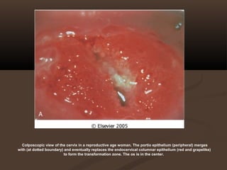 PATHOLOGY OF THE CERVIX | PPT