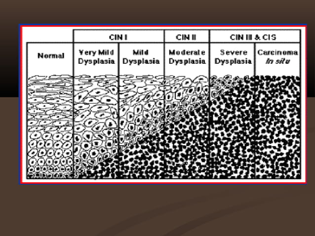 PATHOLOGY OF THE CERVIX | PPT | Reproductive Health | Diseases and ...