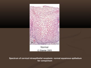 PATHOLOGY OF THE CERVIX | PPT