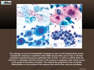 PATHOLOGY OF THE CERVIX | PPT