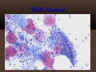 PATHOLOGY OF THE CERVIX | PPT