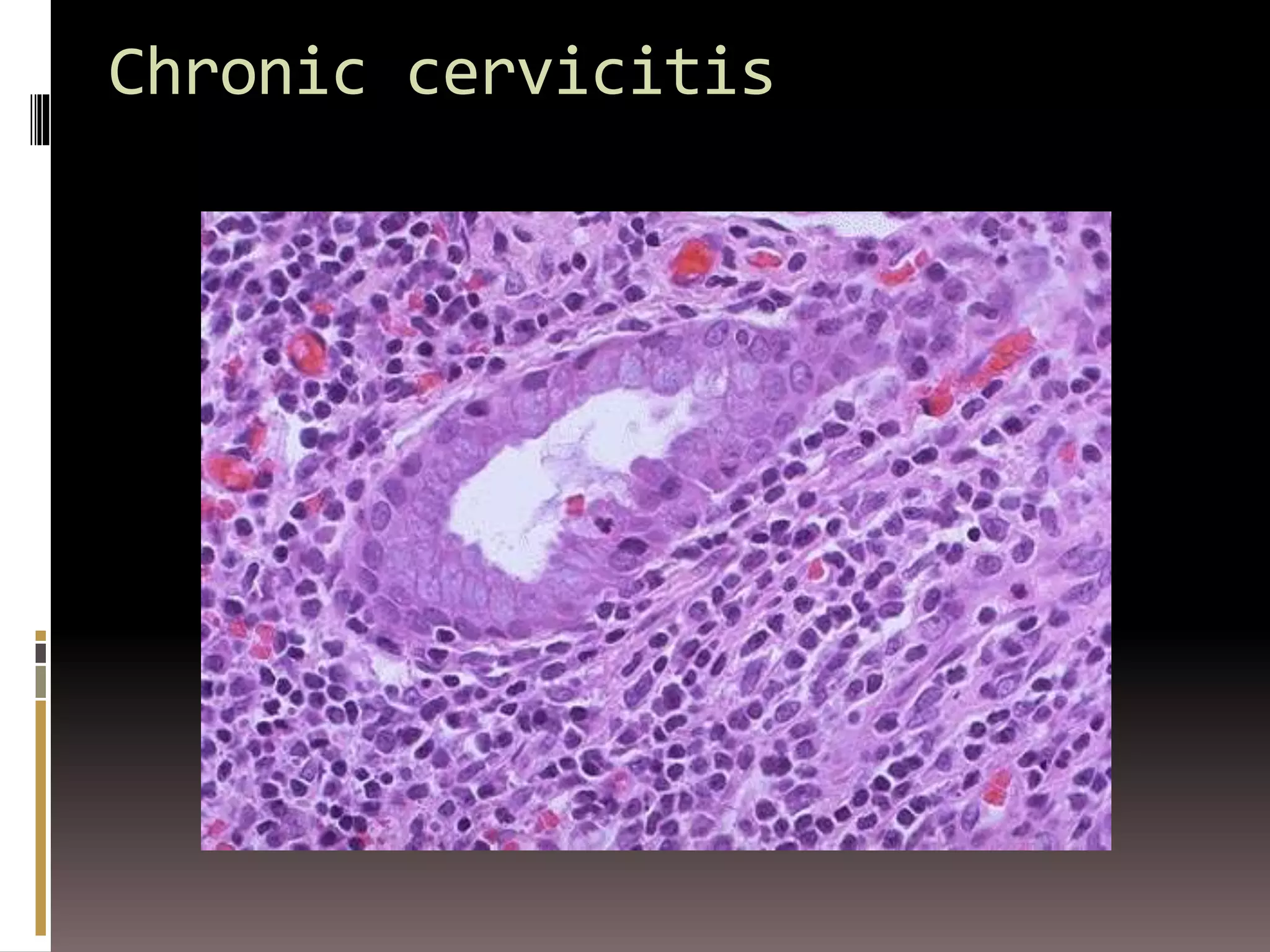 Cervix | PPTX
