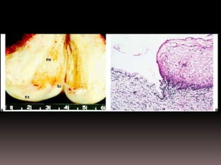Cervix | PPTX