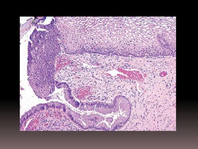 Cervix | PPTX
