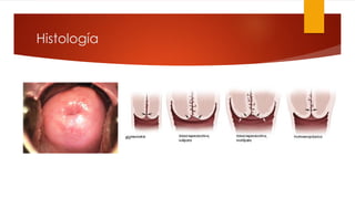 CERVIX - Embriología, anatomia e histología | PDF