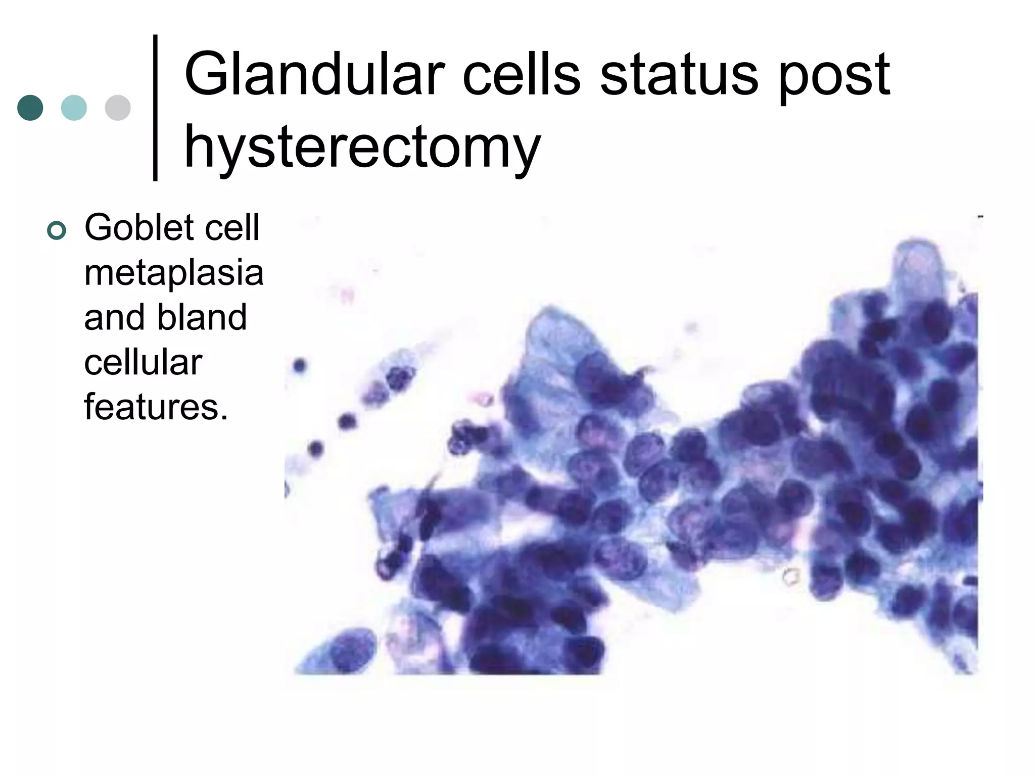 Cervix bethesda system | PPT