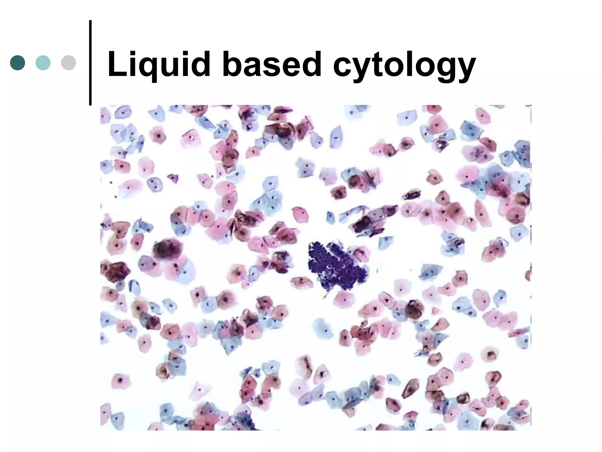 Cervix bethesda system | PPT
