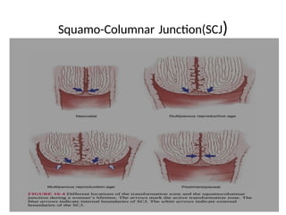 cervix anatomy and its clinical implication.pptx