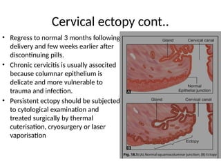 cervix anatomy and its clinical implication.pptx