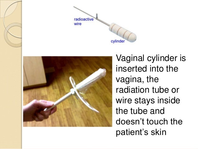 Radiation for Cervix Cancer