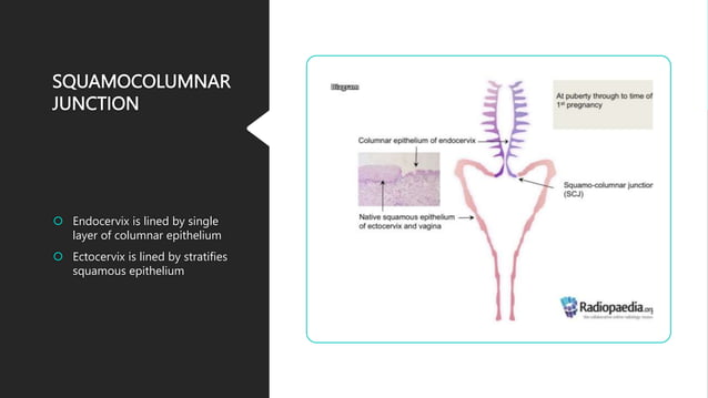 Anatomy of cervix | PPTX
