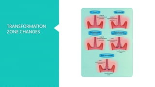 Anatomy of cervix | PPTX