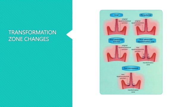 Anatomy of cervix | PPTX