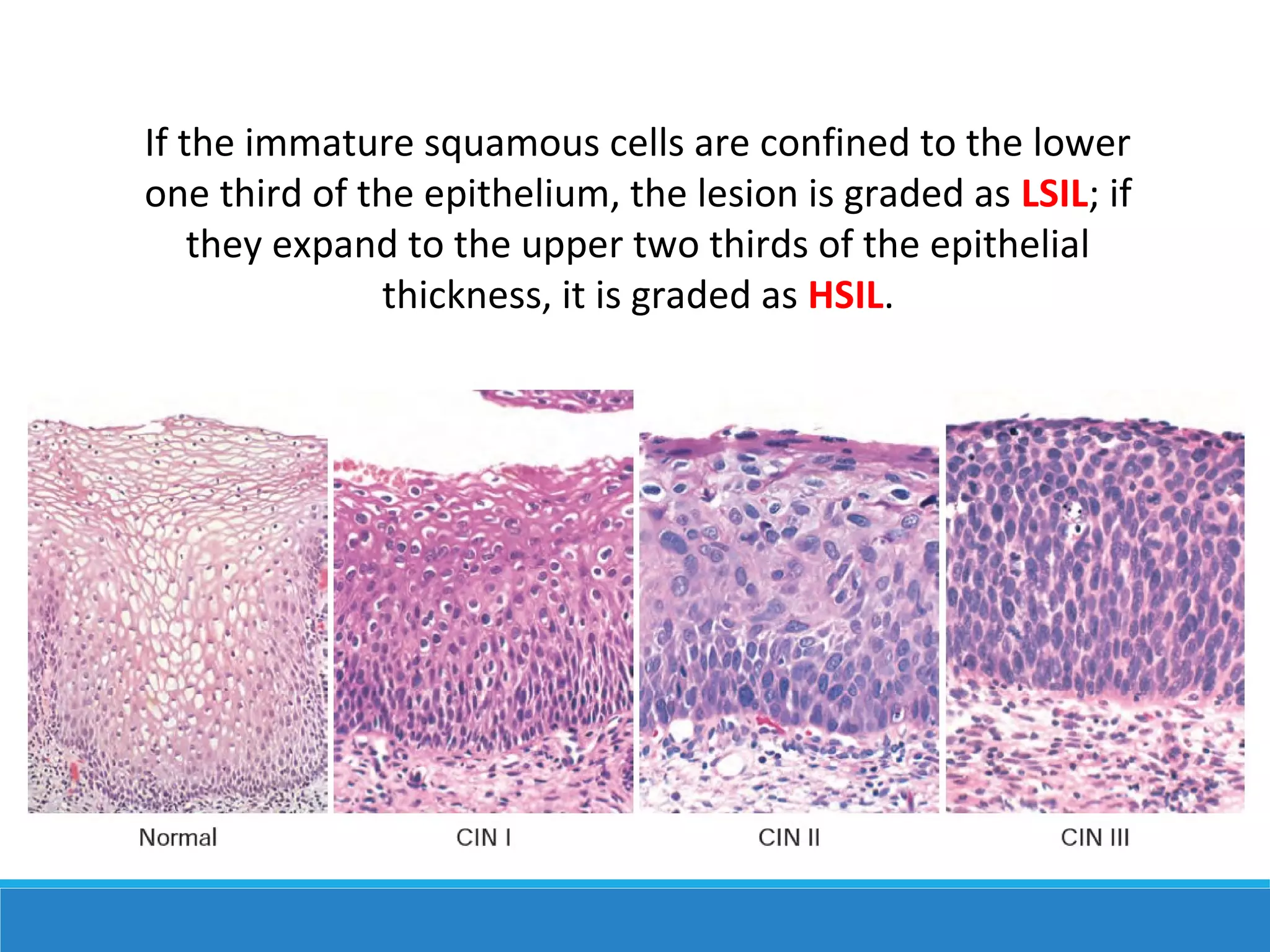 Pathology of Cervix | PPT